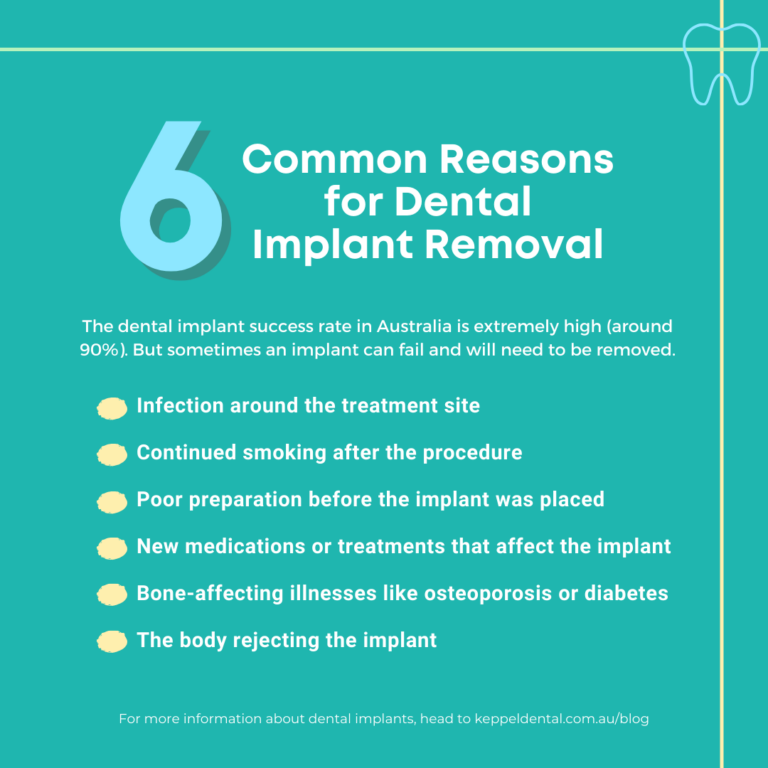 Why Your Dental Implant May Need Removing